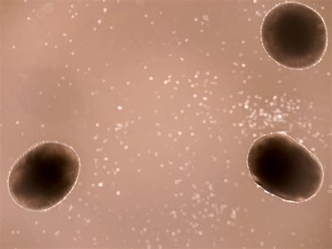 Help Identifying Primary Objects Image Analysis Imagesc Forum