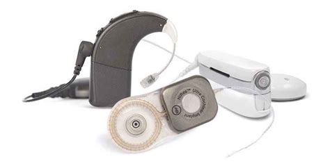 Advanced Bionics Cochlear Implant System