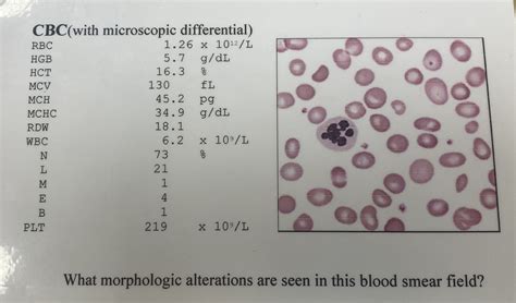 Solved What Is The Diagnosis Of This Patient Short