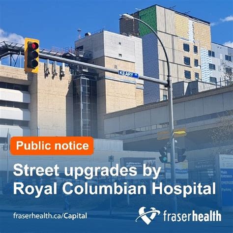 Eric Abel On Linkedin This Enhancement Will Turn Out Great For The