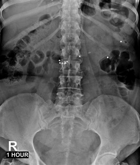 Image Radiopaedia Org