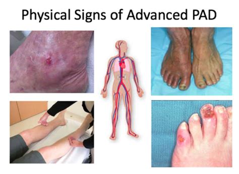 Chapter 22 Peripheral Assessment Exam 3 Flashcards Quizlet