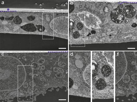 Optimization Of Membrane Staining For Fib Sem Cells Are Embedded Download Scientific Diagram