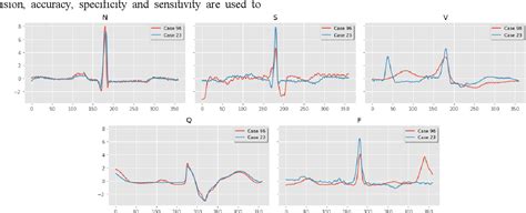 figure 2 from classification of ecg signals encrypted with cnn based