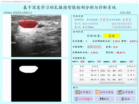 基于深度学习的乳腺癌智能检测分割与诊断系统【python源码 pyqt5界面 数据集 训练代码】深度学习实战、目标分割、人工智能 知乎