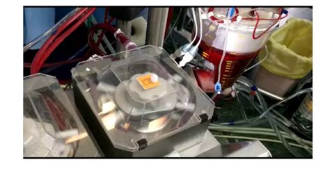 Pulsatile Vs Non Pulsatile Perfusion Pptx