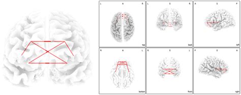 Phase Synchronization Analysis Demonstrating Increased Functional Download Scientific Diagram
