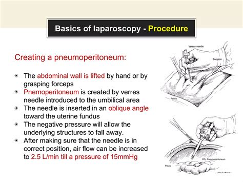 Laparoscopy In Gynecology Pdf