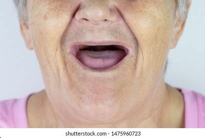 7 Hundred Toothless Old Woman Royalty Free Images Stock Photos Pictures Shutterstock