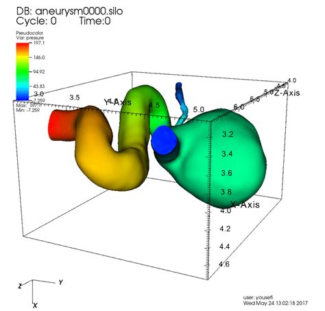 Bulk Contour Of Loaded Unstructured Grid Data Aneurysm Fluid Dynamics Download Scientific