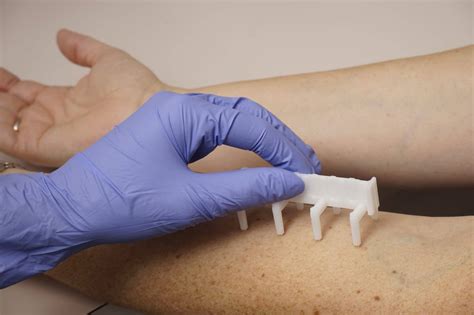 Allergy Testing Midwest ENT Centre