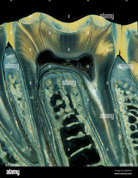 Light Microscopy Of A Tooth Plane Polarized Light Micrograph Of A