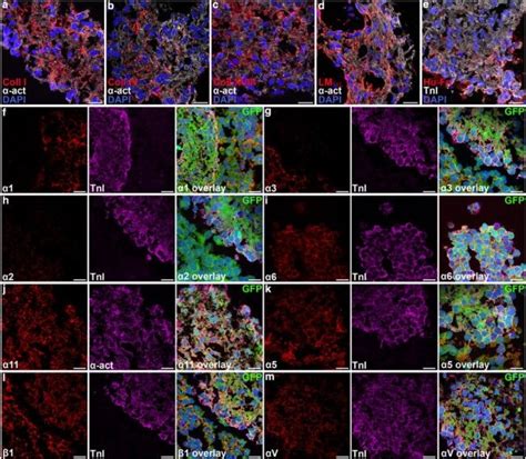 Extracellular Matrix And Integrin Expression In Beating Areas From