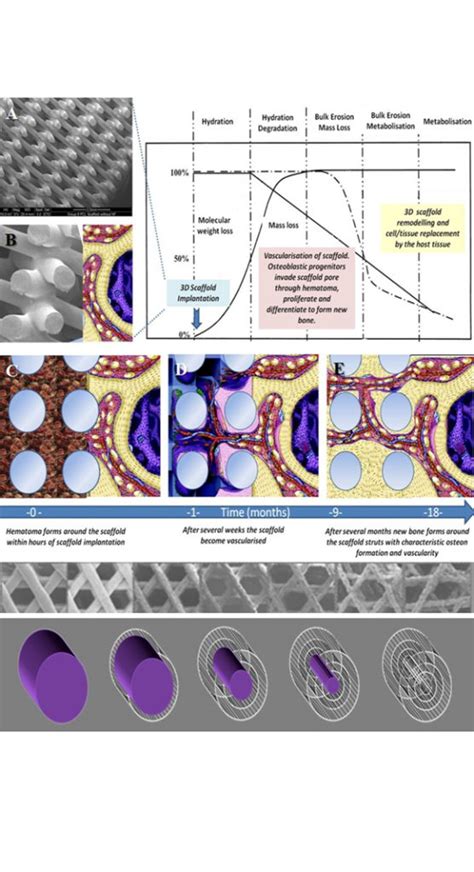 Scaffold Guided Breast Reconstruction Innovation News Network