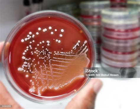 스타필로코커스 아우레우스 그람 양성 그람가변 비운동성 코쿠스 베타 용혈 혈액 한천에서의 스타필로코커스 성장에 속하는 사프로토릭성 박테리아 박테리아에 대한 스톡 사진 및 기타