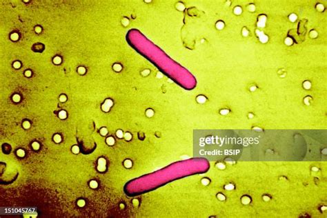 Salmonella Enteritidis