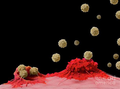 T Cells Attacking Cancer Cells Photograph By Tim Vernon Science Photo