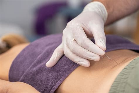 Dry Needling Vs Acupuncture How Are They Different