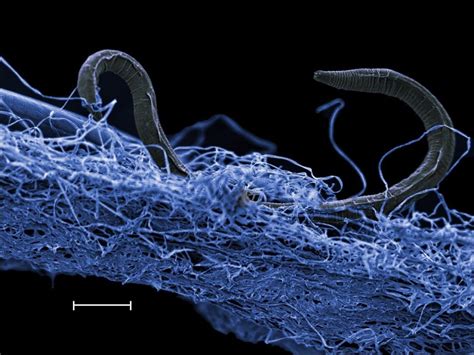 If Male And Female Brains Are Wired Differently Could These Worms Show How It Happens The