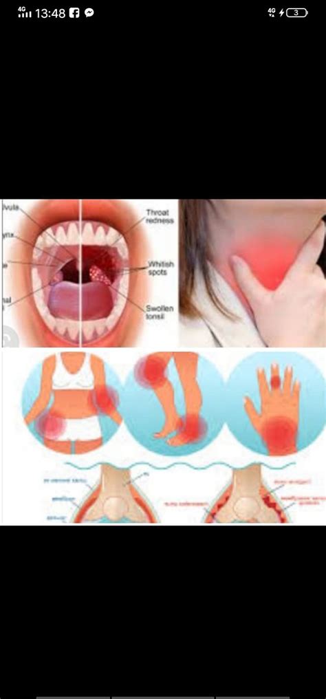 бамбай булчирхайн дутагдал Зангилаа Facebook