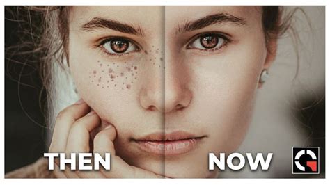 How To Remove Spots On Face With Easy Steps On Photoshop Skin Retouching Photoshop Photoshop