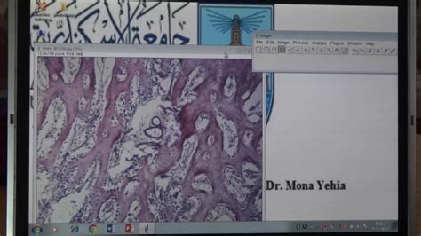 How Are You Using Image J Software Youtube