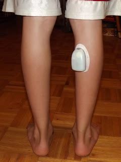 God Is Good A New Omnipod Placement Site