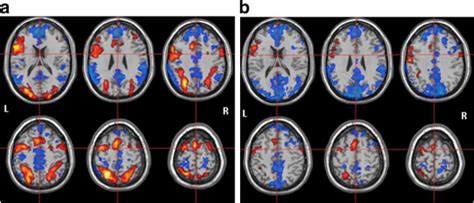 Fmri Results To The Control Group Bold Activation Red And