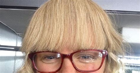 See Brooklyn Decker With Pimples Braces And Nerd Glasses E Online