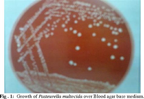 Figure 1 From Antibiotic Susceptibility And Molecular Analysis Of Bacterial Pathogen Pasteurella