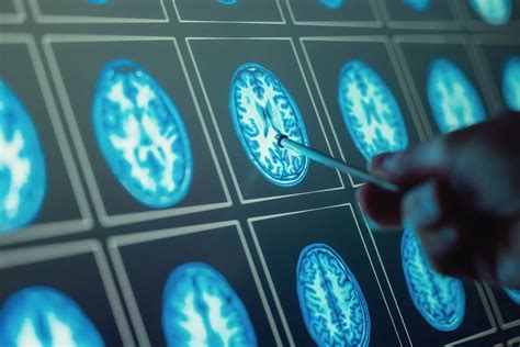 Guide To Ldl Hdl Ratio Levels Levels