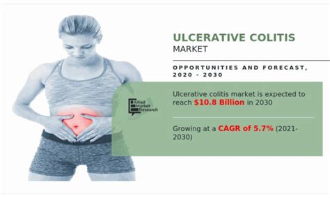Ulcerative Colitis Market To Reach 108 Billion By 2030 Newstrail