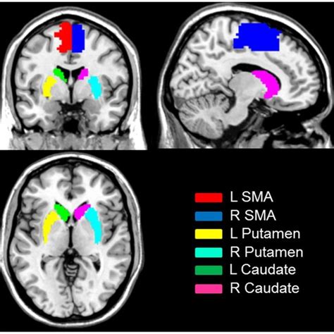 Pdf Enhanced Functional Connectivity Between Putamen And Supplementary Motor Area In Parkinson