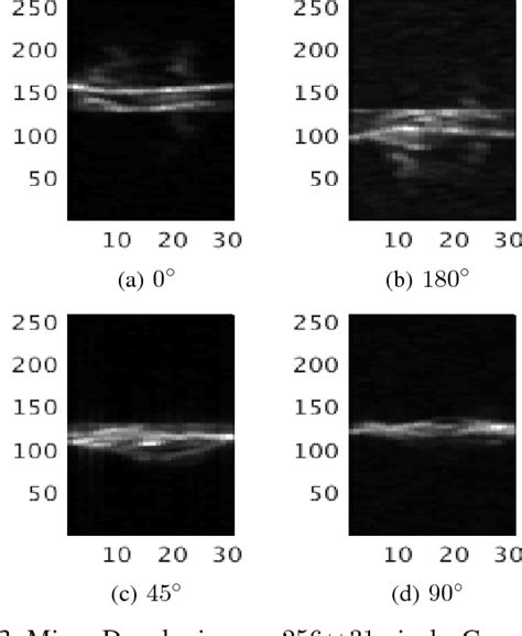 Figure 1 From Micro Doppler Feature Extraction Using Convolutional Auto Encoders For Low Latency