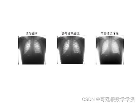 matlab环境下基于同态滤波方法的医学图像增强 matlab图像进行同态滤波 csdn博客