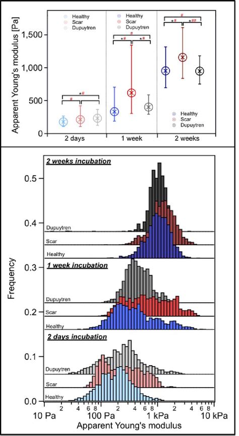 box plot median with 25 75 percentiles and histogram distribution of