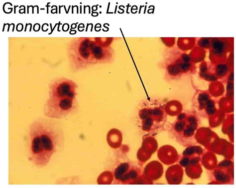 Listeria Gram Listeria Surviving Bacteria