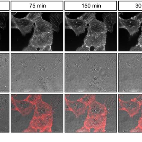 Long Term Live Cell Imaging Of Cultured Cells Inside The Incubator Download Scientific Diagram