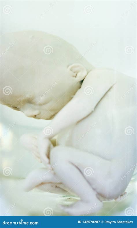 Fetus In Formalin Solution Stock Image Image Of Placenta 142578287
