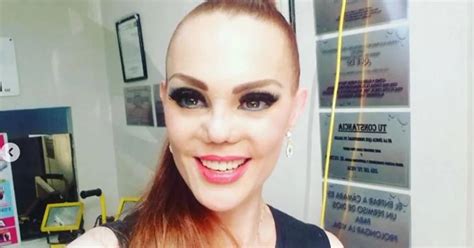 Carmen Campuzano Anhela Recuperar Su Nariz Y Ya Buscó Ayuda De Los