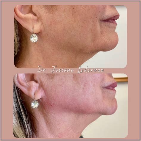 Its All Dr Josiane Lederman Dermatology Associates