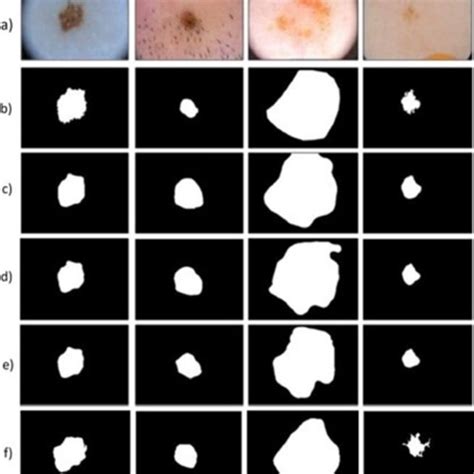 The Ablation Experiment Segmentation Diagrams For The Input Image A