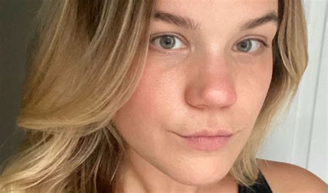 I Just Finished 5 Months Of Isotretinoin—heres How It Went The Everygirl
