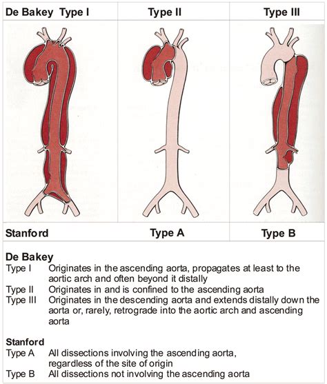 type b dissection management