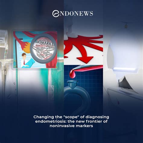 Current Status Of Non Invasive Biomarkers For Endometriosis Endonews