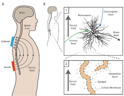 Figure 7 From Trans Spinal Direct Current Stimulation For The
