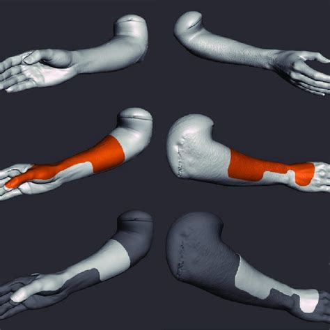 Best Fit Alignment Up And RPS Alignment Down Download Scientific Diagram