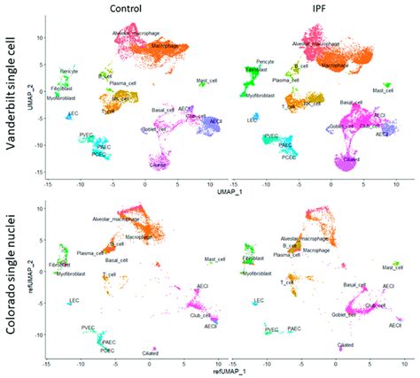 Top Umap Clustering Of The Vanderbilt Ipf Single Cell Rna Sequencing