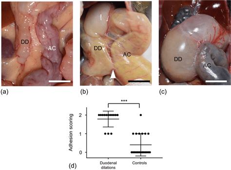 Macroscopic Appearance Of The Duodenum And Colon A Control Case No Download Scientific