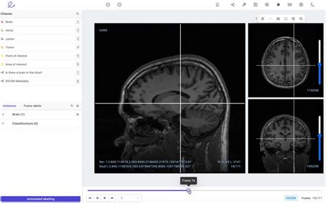 Encord On Linkedin 6x Your Labelling Efficiency With The First Purpose Built 3d Annotation…